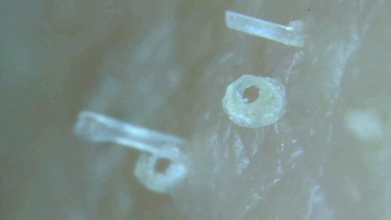 Beard Plucking : Microscope Art File(241) - YouTube