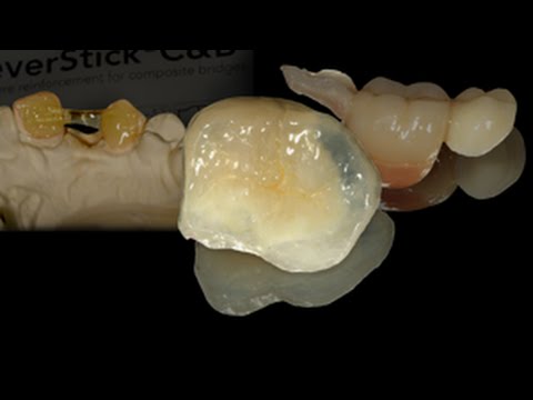 Ceramic Composite by LSK121 Oral Prosthetics - YouTube