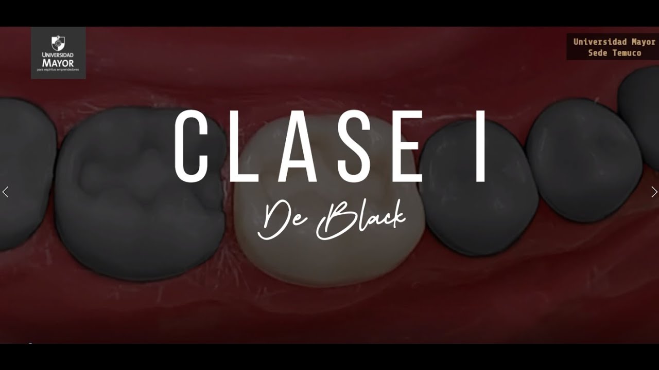 Preparación clase I de Black | Paso a paso - YouTube