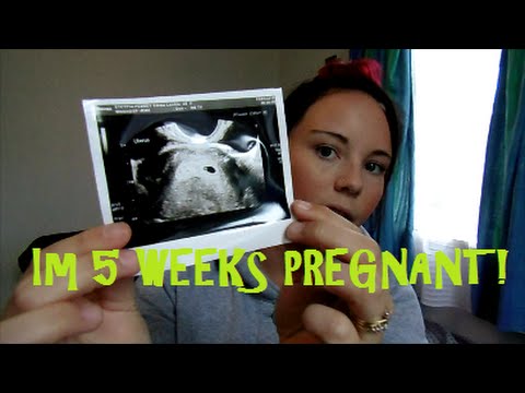 5 Week Update | When Am I Due?? - YouTube