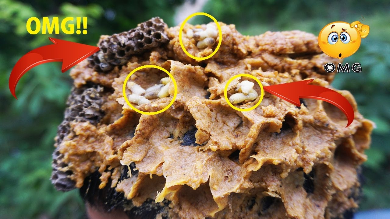 Hugely Worms Head!! Removing 100k Worms On Itchy Scalp Psoriasis #487 ...