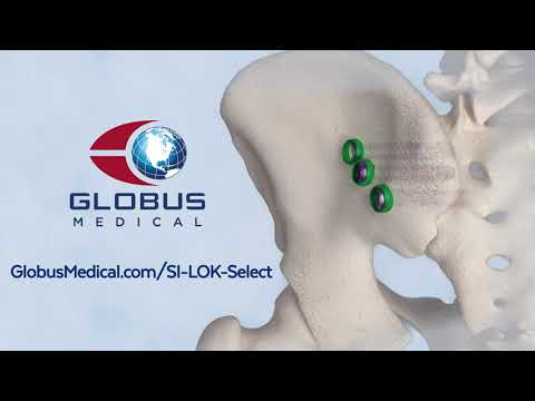 SI-LOK® SELECT Sacroiliac Joint Fusion System - YouTube