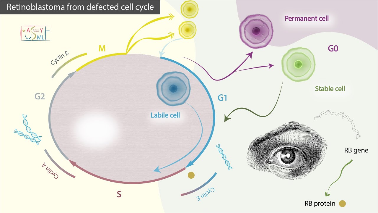 Retinoblastoma from defected cell cycle - YouTube