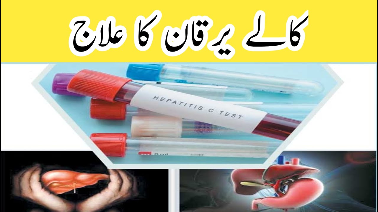 Hepatitis C Ka ilaj !!!! Kaly yarqaan Ka Ilaj by Hakeem Hafiz Muhammad ...