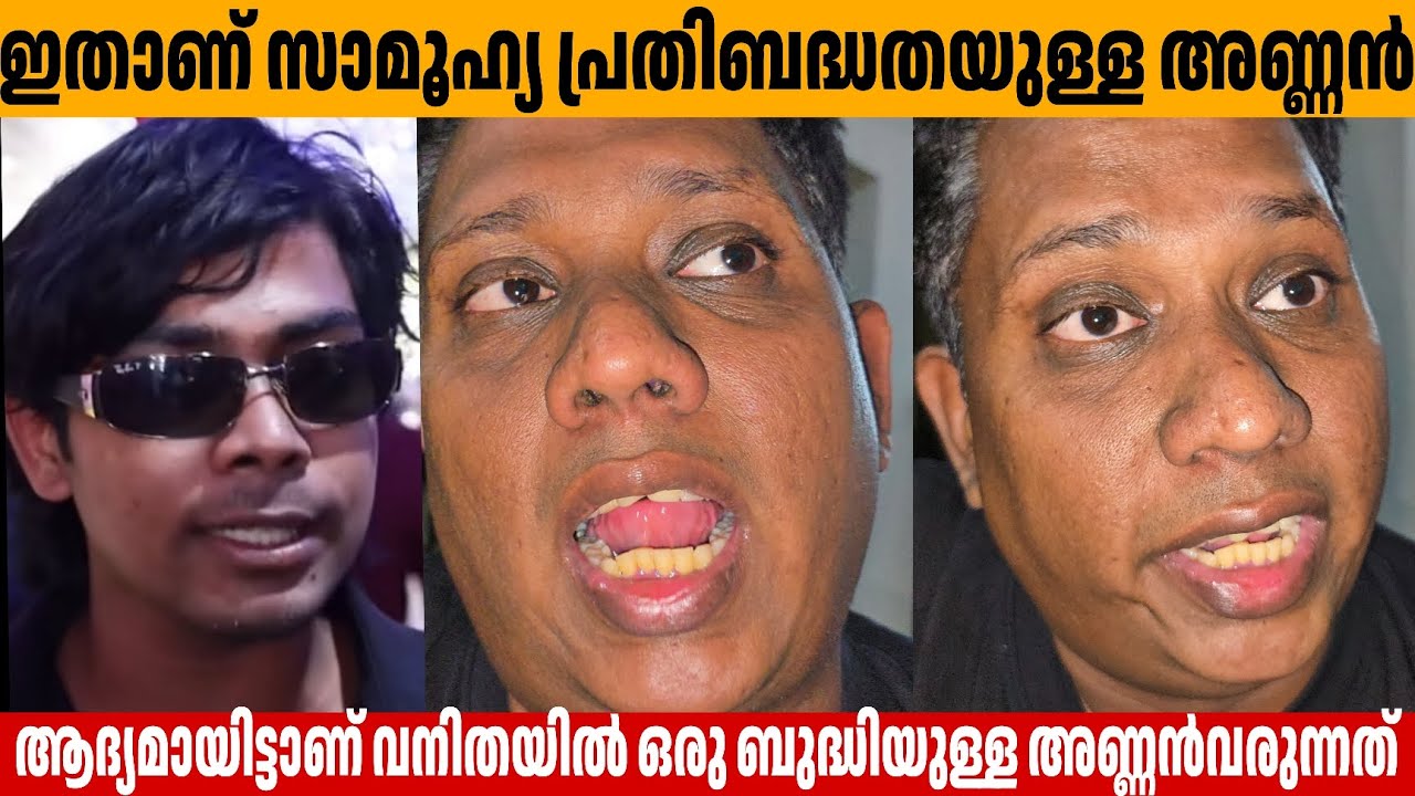 ഇതാണ് സാമൂഹ്യ പ്രതിബദ്ധതയുള്ള അണ്ണൻ Santhosh Varkey Aarattuannan - YouTube