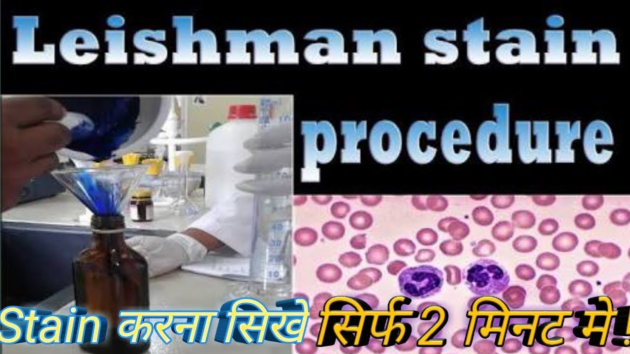 Lishman stain Procedure - YouTube