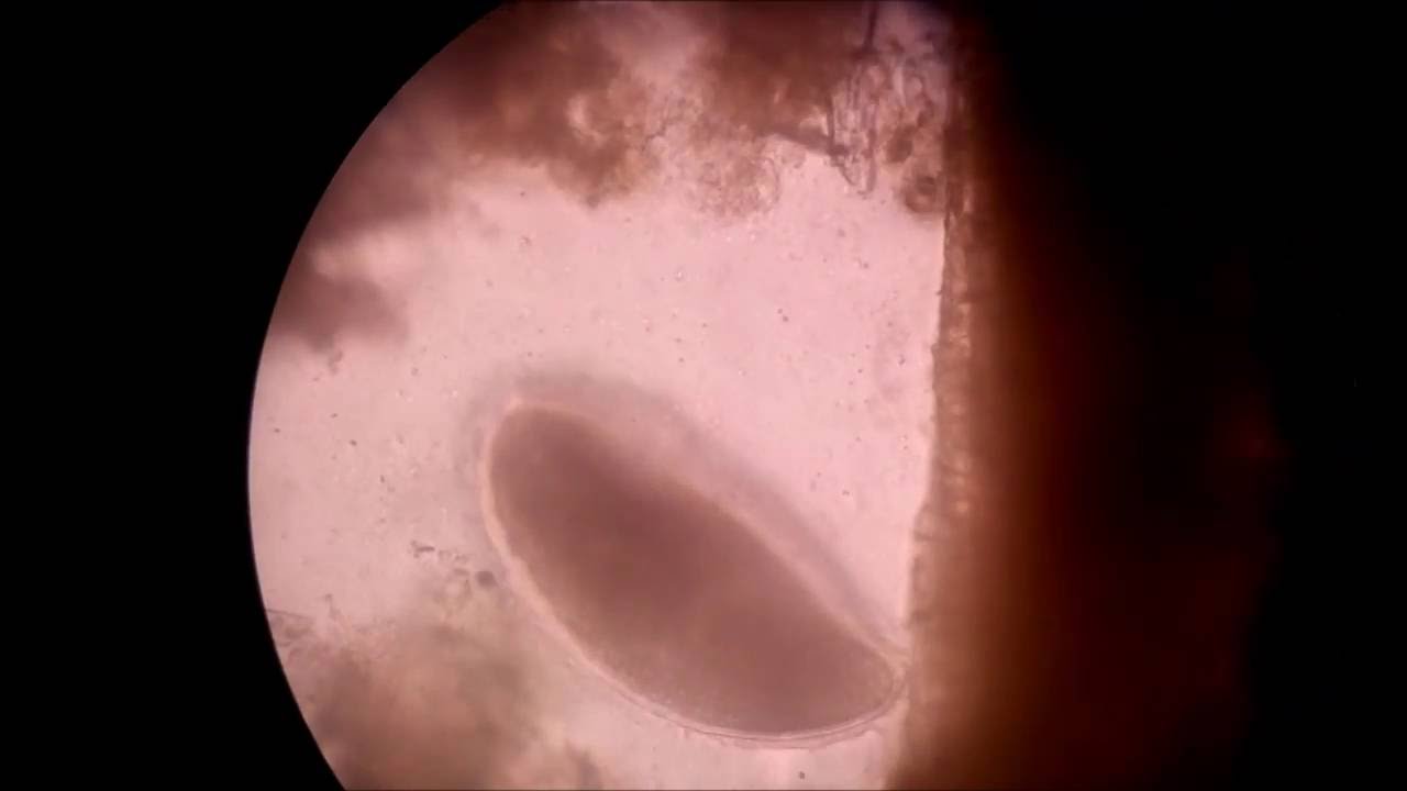 Balantidium Coli Trofozoito Youtube