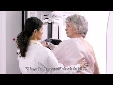 3 boyutlu Mamografi,Meme Tomosentezi,3D Breast Tomosynthesis,  3D Mammography