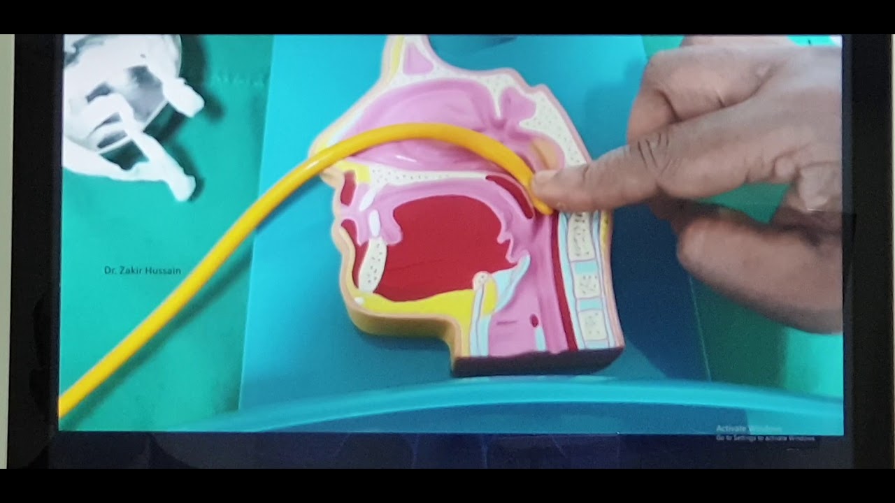 Nose bleed Part 6 (Tamil) Patient teaching programme Different ...