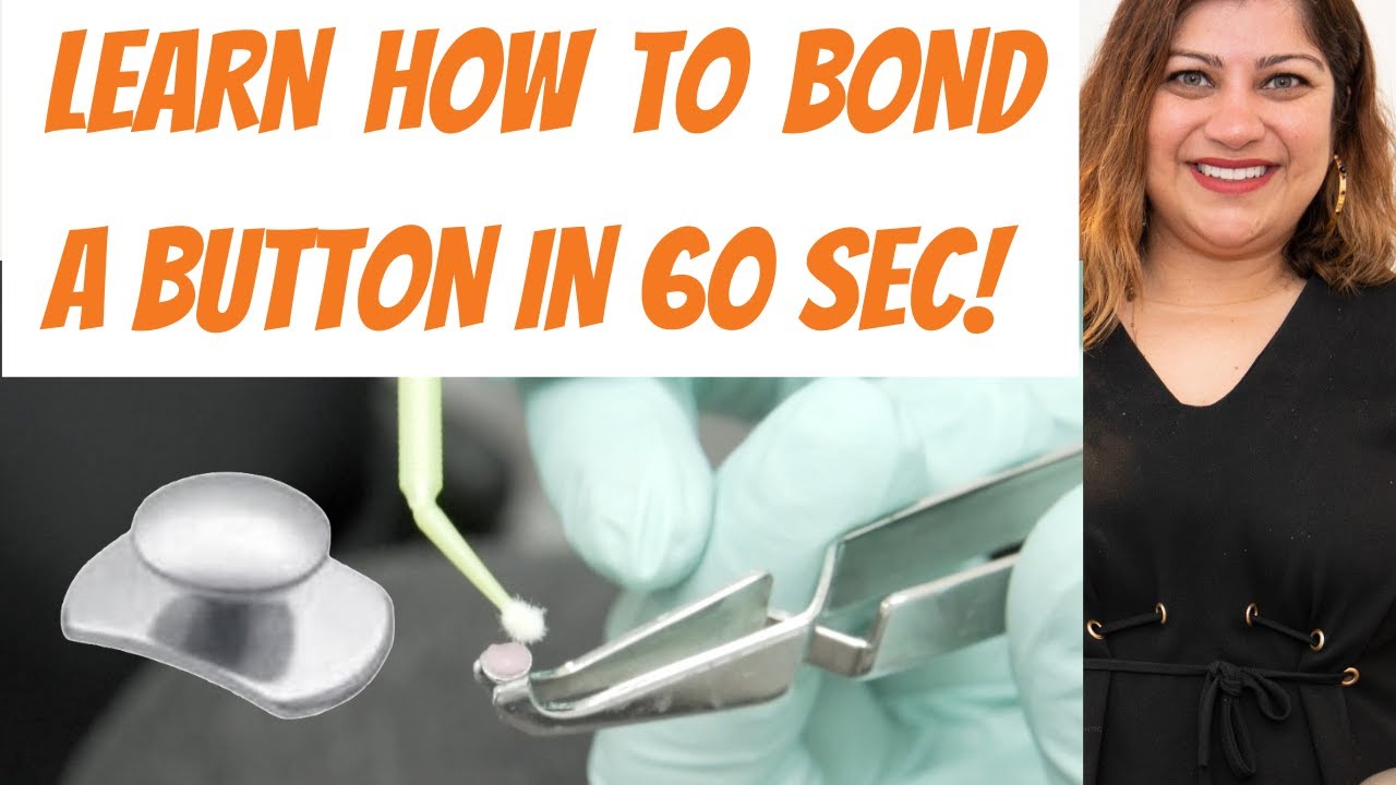 Learn how to bond an orthodontic button in 60 seconds in 5 simple steps ...