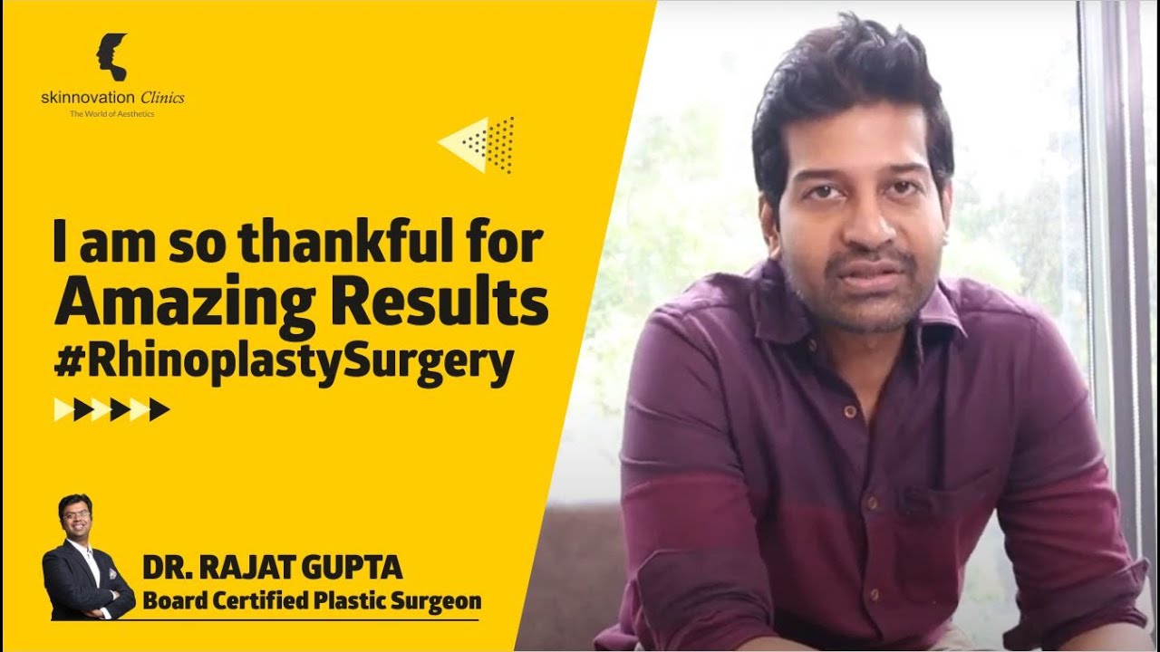 " I am so thankful for Amazing Results " | Rhinoplasty Surgery ...