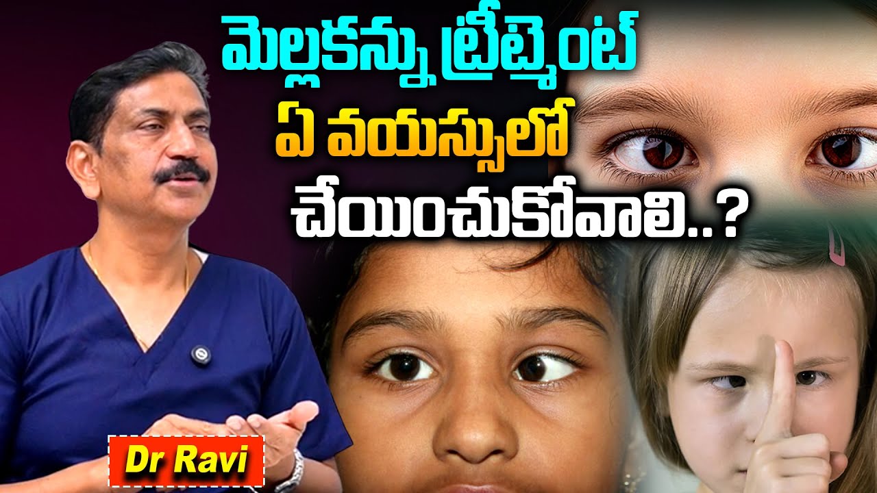మెల్లకన్ను ట్రీట్మెంట్ ఎప్పుడు చేయించుకోవాలి..? Squint Eye Treatment ...