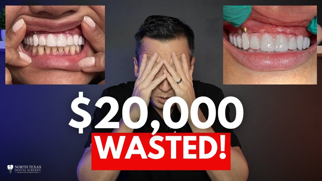 Implant Nightmares: One Woman's Dental Disaster - YouTube
