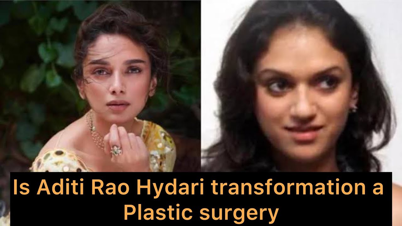 Has Aditi Rao Hydari undergone plastic surgery| Is Aditi Rao Hydari ...
