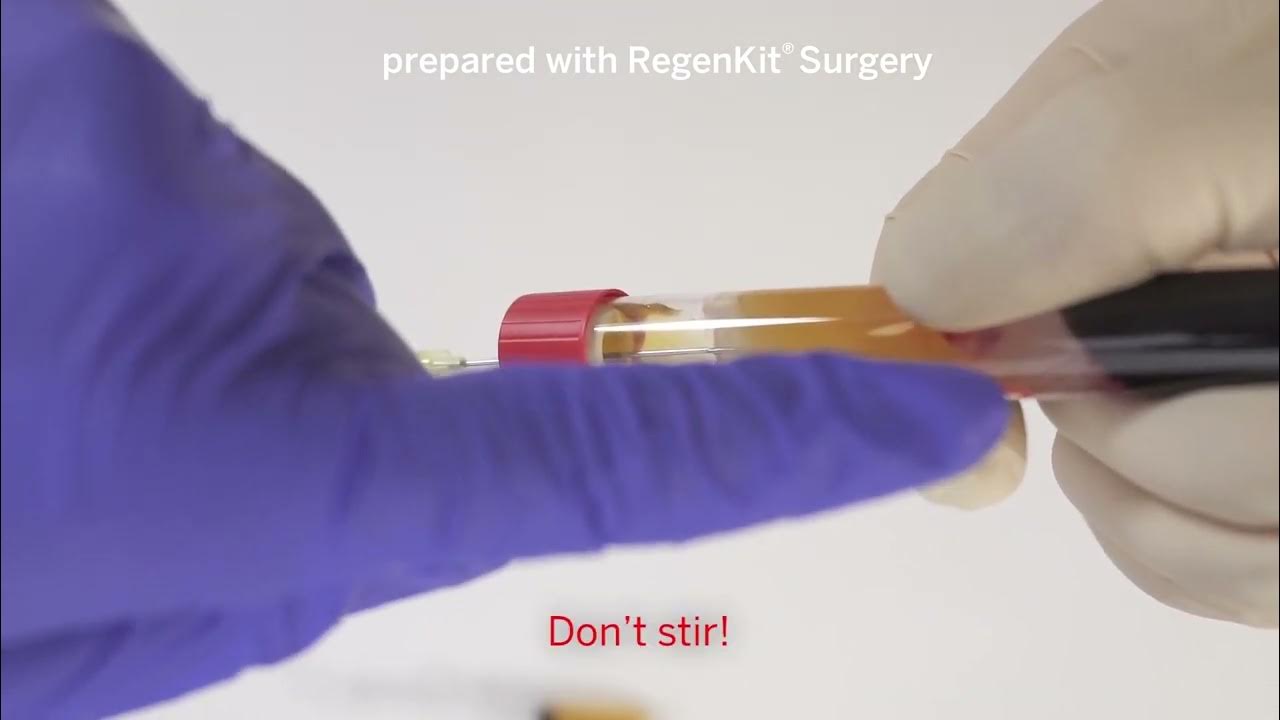 Video Regenlab PRP ATS WOUND - YouTube