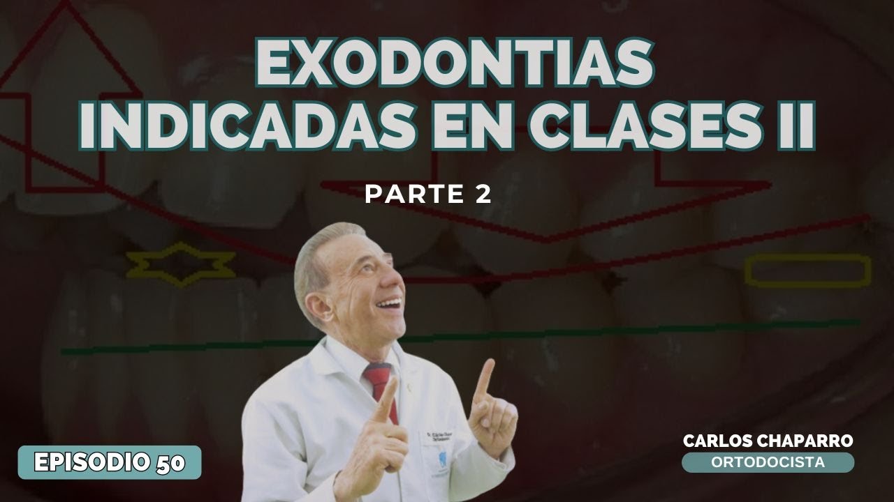 EXODONCIAS INDICADAS EN CLASES II (2 EXODONCIAS) - PARTE 2 - EPISODIO 50 - YouTube