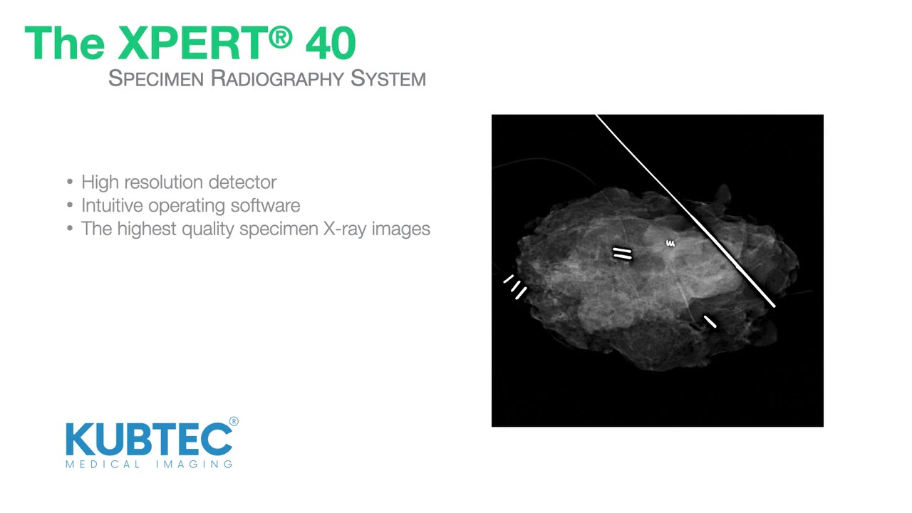 The XPERT 40 Radiography System with The Image Blender™ - YouTube