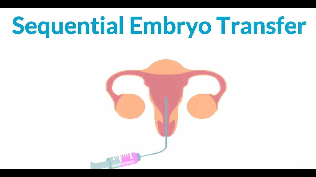 Sequential Embryo Transfers - YouTube