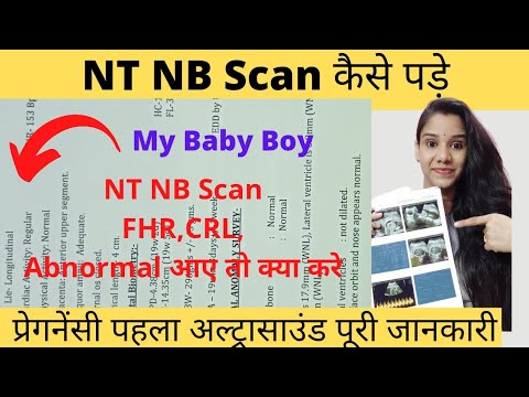 How to Read NT NB Scan in 3 months Pregnant | घर NT स्कैन रिपोर्ट पड़ना ...