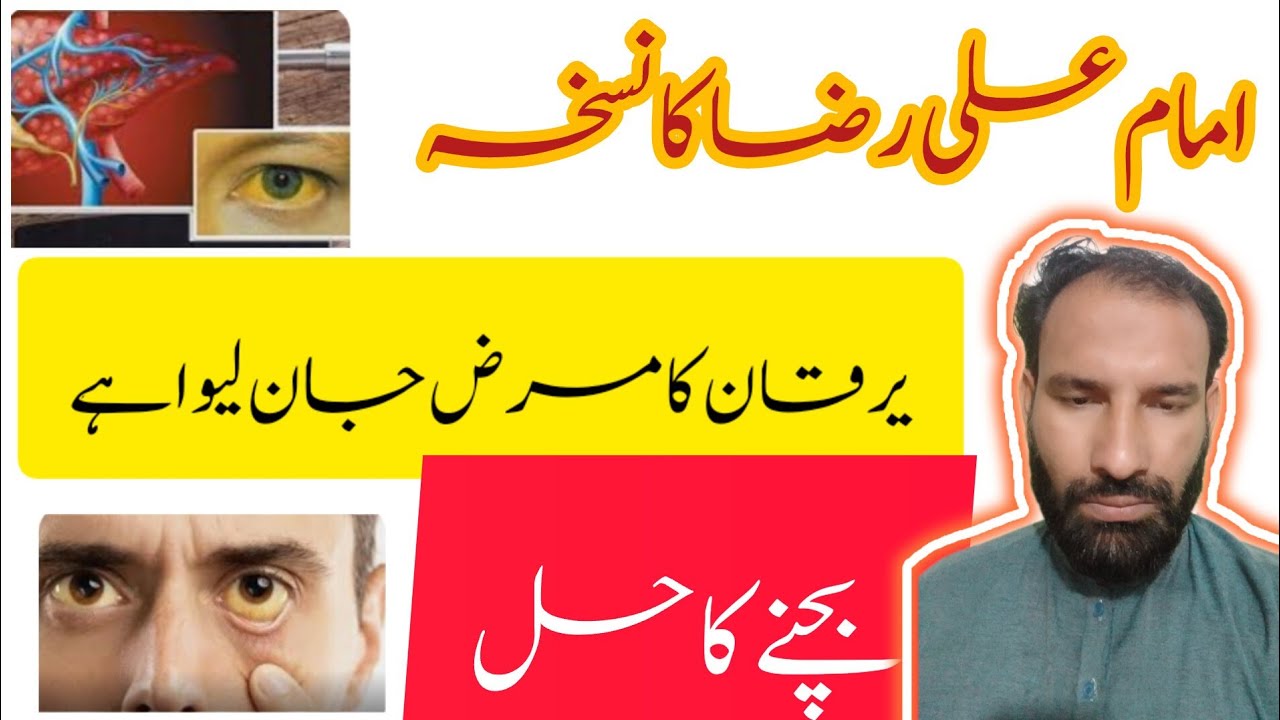 yarqan sy bachy ka hal imam Raza a.s ka nuskha//tib e imam razaIGM ...