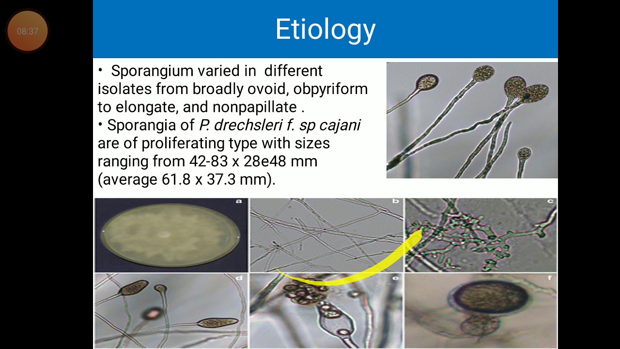 Pigeon-pea Phytophthora blight by Pratibha Bhagat - YouTube