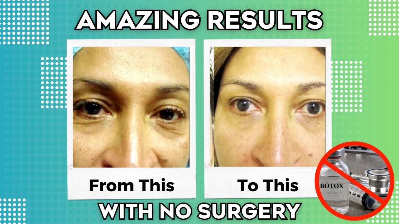 Astonishing face transformation results 2024!!! - YouTube