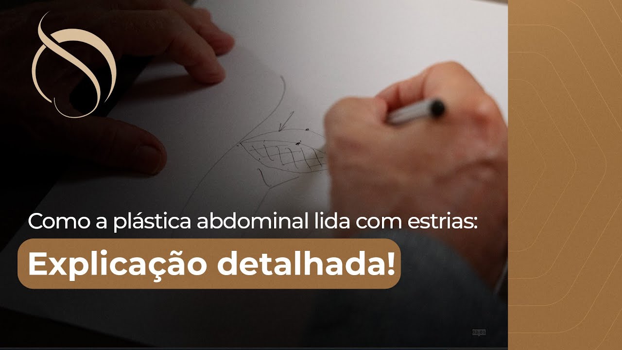 Como a plástica abdominal lida com estrias: Explicação detalhada! - YouTube