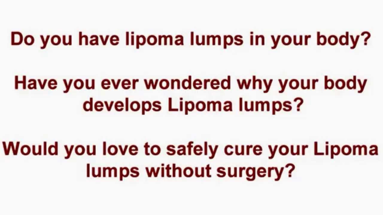 Lipoma Treatment 157000 Satisfied How To Cure Lipoma With Out Surgery ...