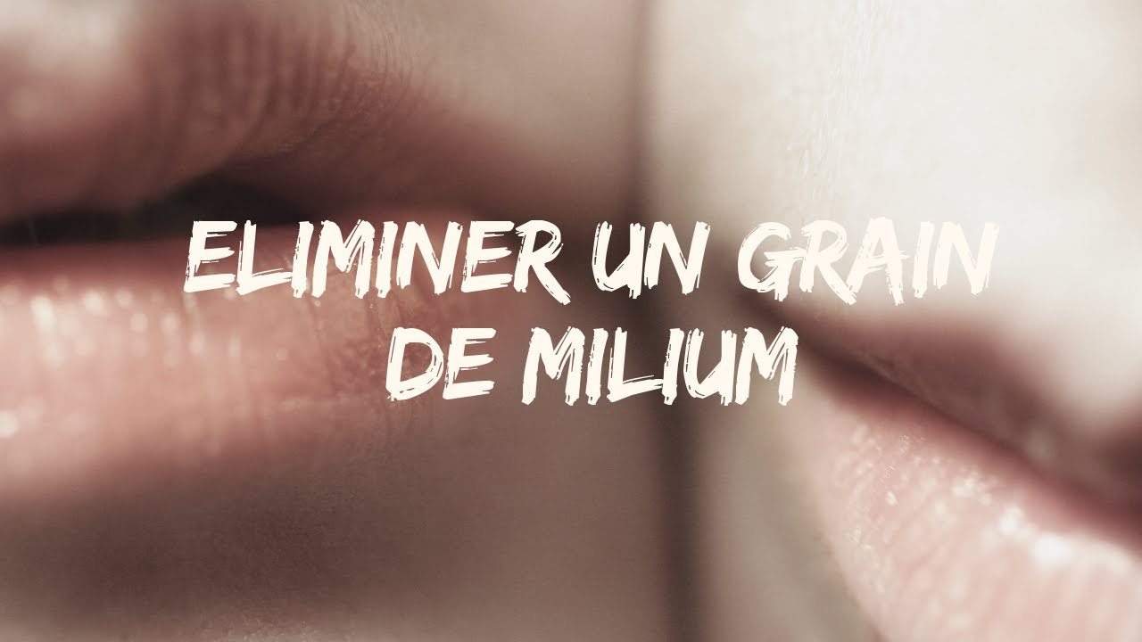 Enlever un grain de milium RAPIDEMENT et PROPREMENT - YouTube