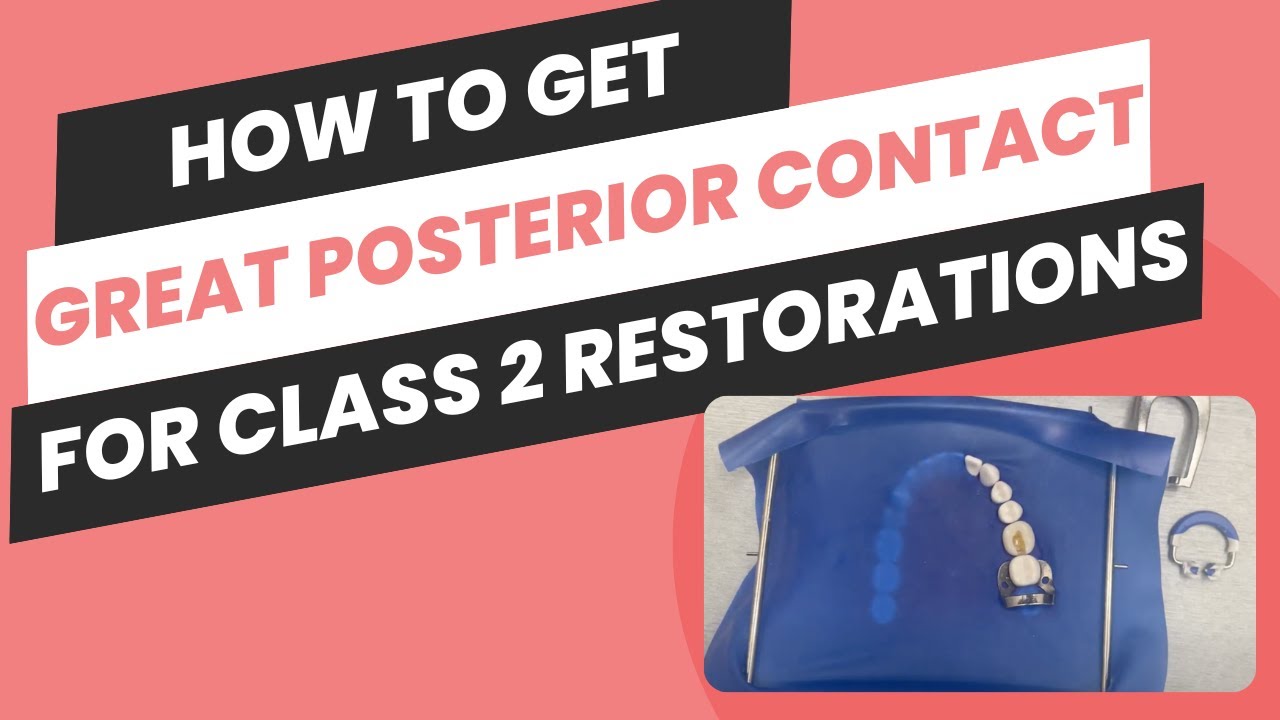 How To Achieve A Perfect Posterior Contact For Class II Restorations On ...