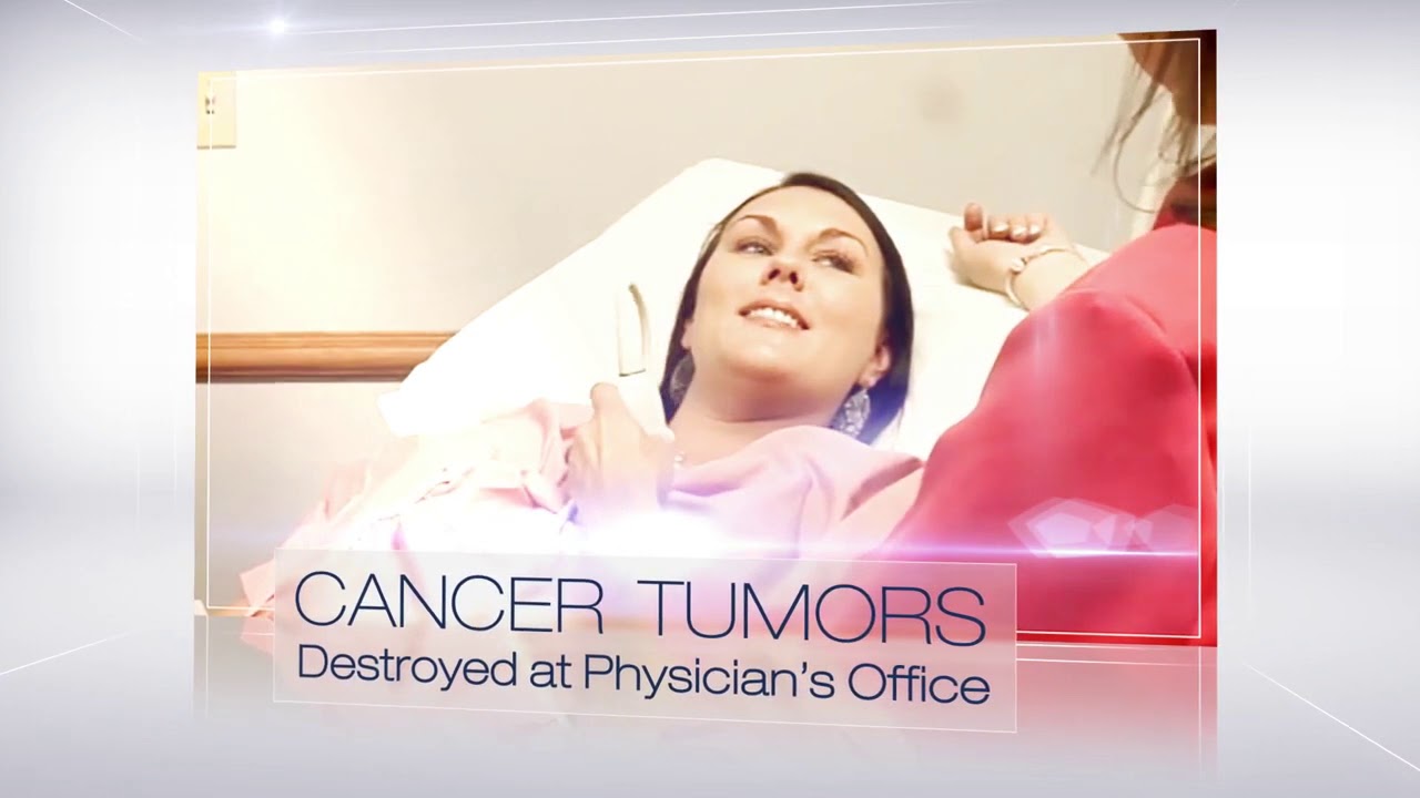 Freezing Tumors with IceCure-ProSense - YouTube