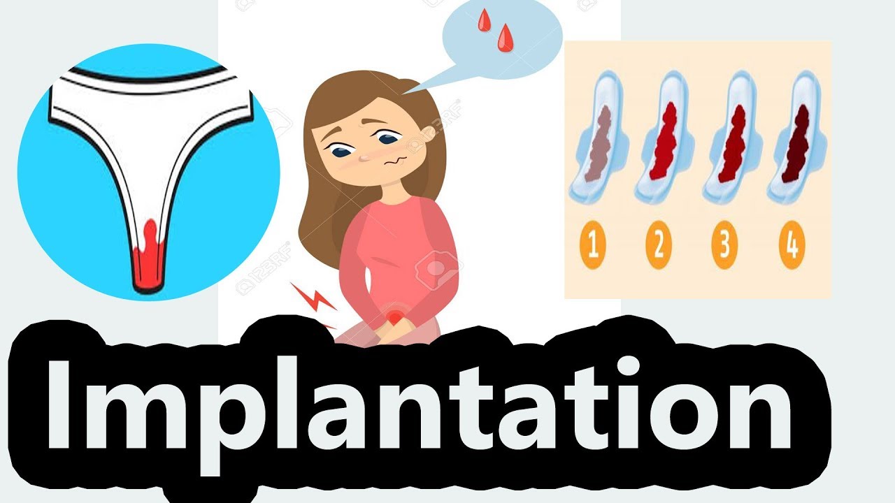 Implantation bleeding: signs, symptoms and what it means - YouTube
