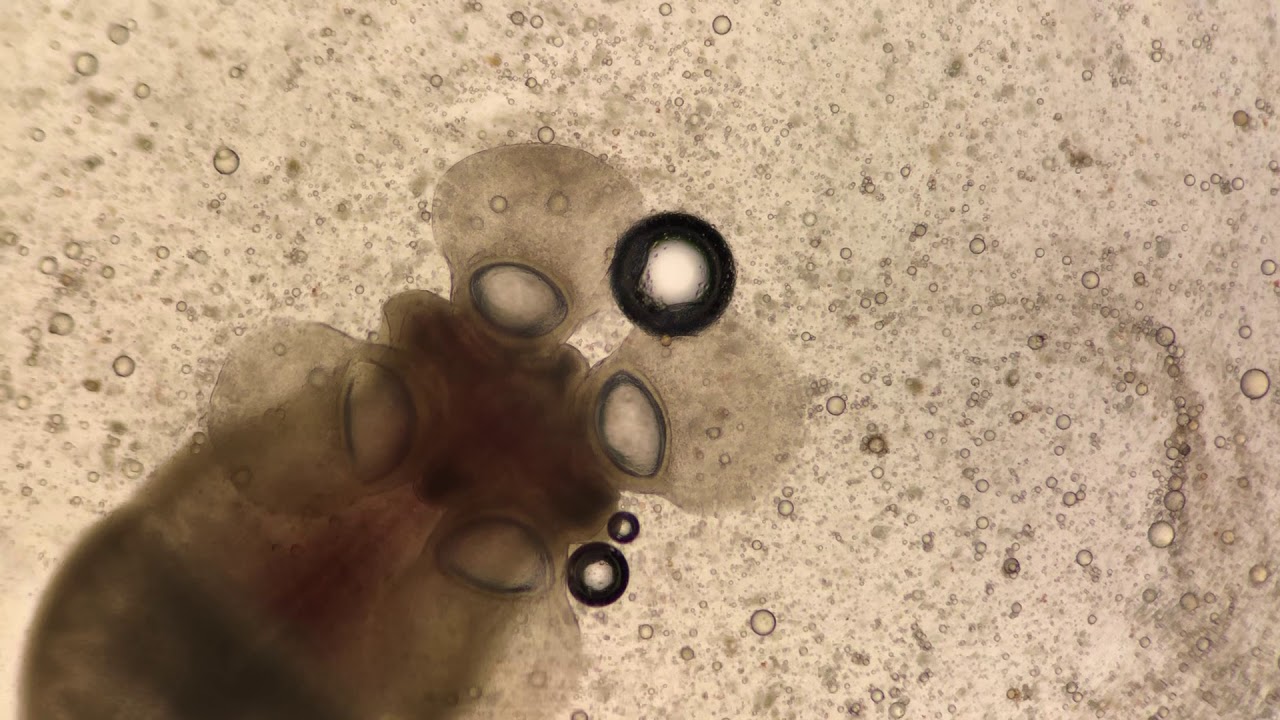 【寄生虫】ジャンプ漫画ト コのデビ 大蛇のような寄生虫：Plerocercoid of Pelichnibothrium or ...