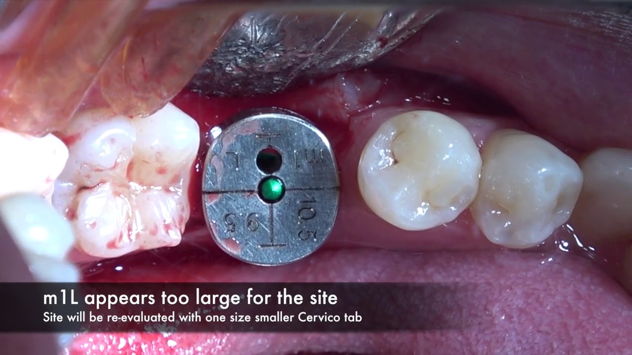 Cervico Concept - YouTube