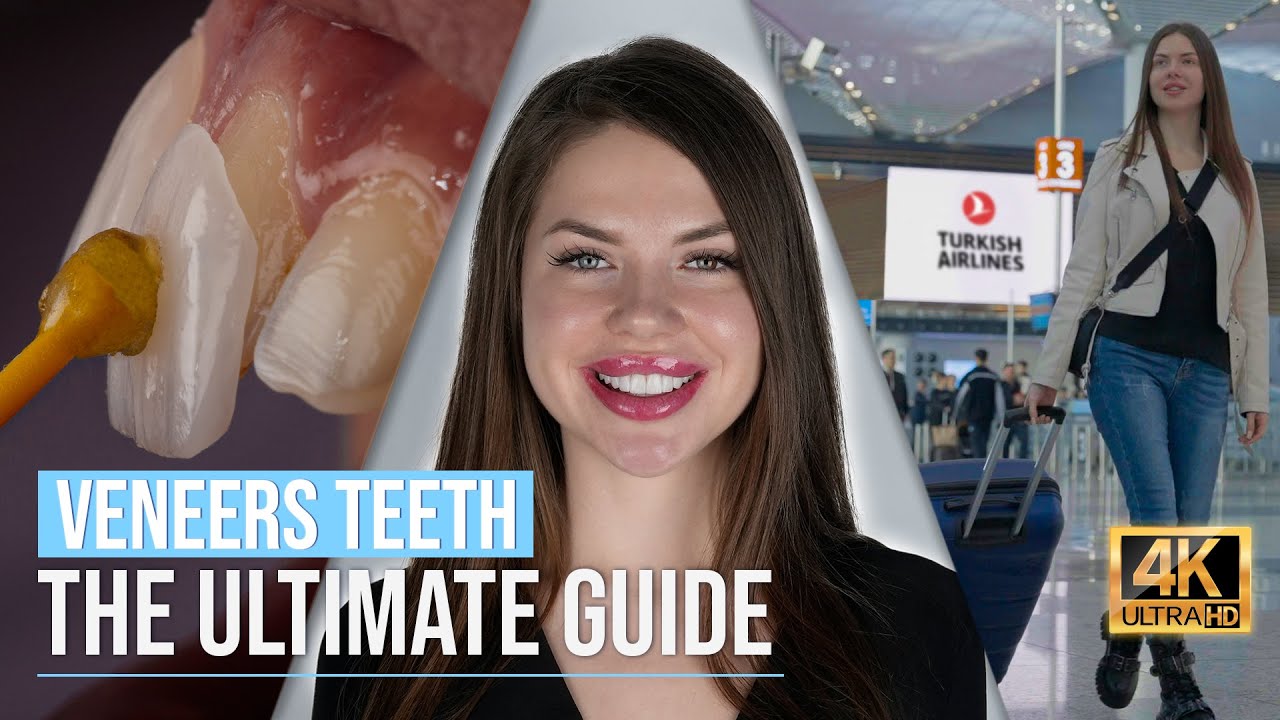 Your Ultimate Guide to Having Veneers teeth in Turkey - YouTube
