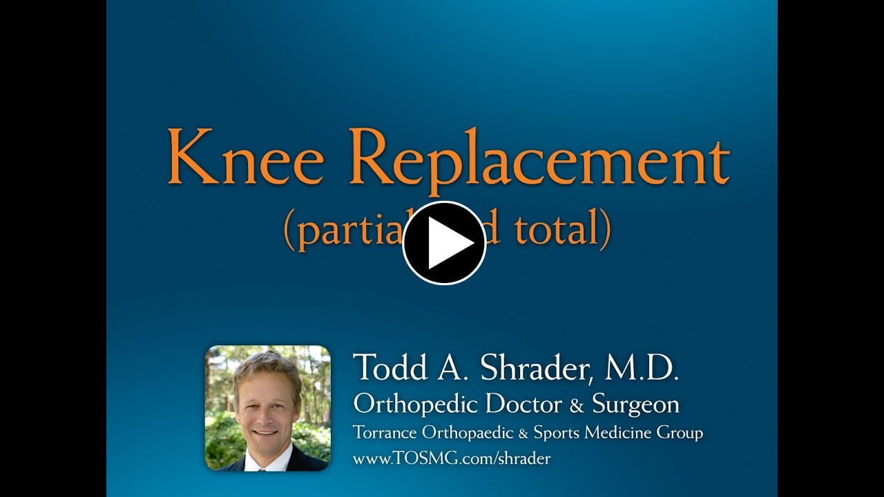 Todd A. Shrader, MD, Orthopedic Doctor, Knee Replacement - YouTube