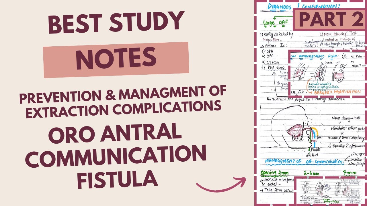 Oro Antral Communication and Fistula Pt 2 | Diagnosis and Management ...