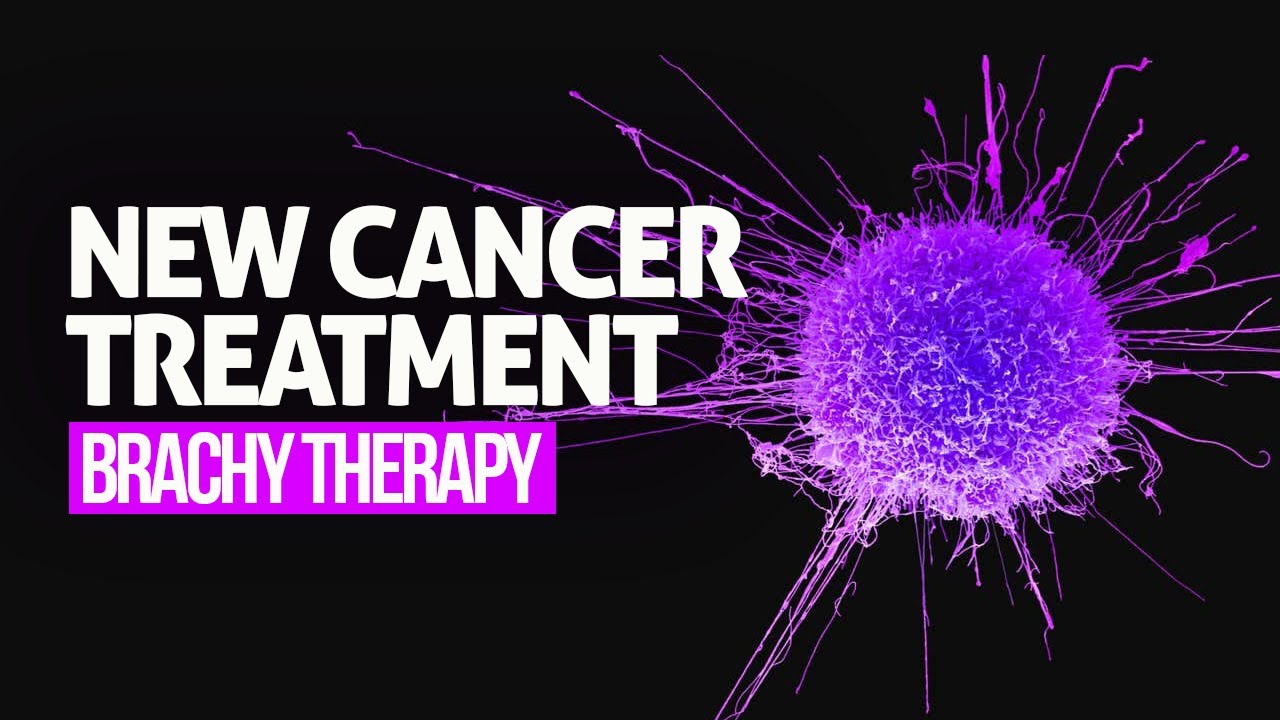Cancer Treatment - Brachy Therapy - YouTube