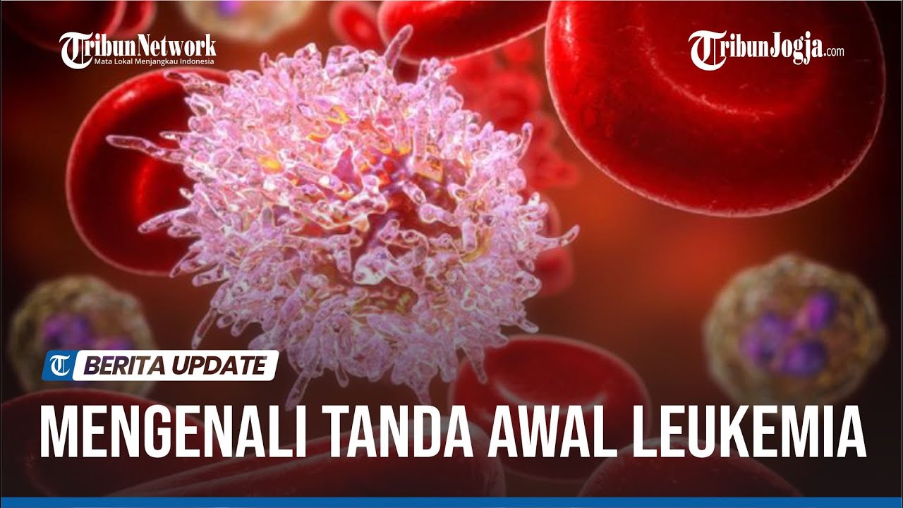 TANDA LEUKEMIA ATAU KANKER DARAH YANG PERLU DIWASPADAI - YouTube