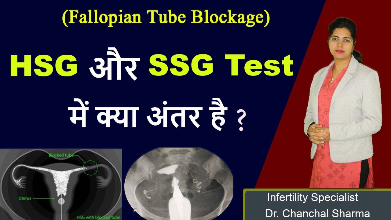 Difference Between HSG and SSG Test for Fallopian Tube Blockage - Aasha ...
