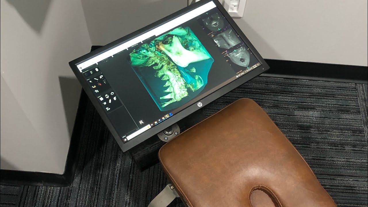 How to upgrade your chiropractic adjusting table (DIY Upper Cervical ...