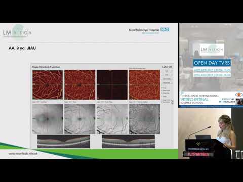 M. Banteka | Angio and En Face OCT in the management of the paediatric patient