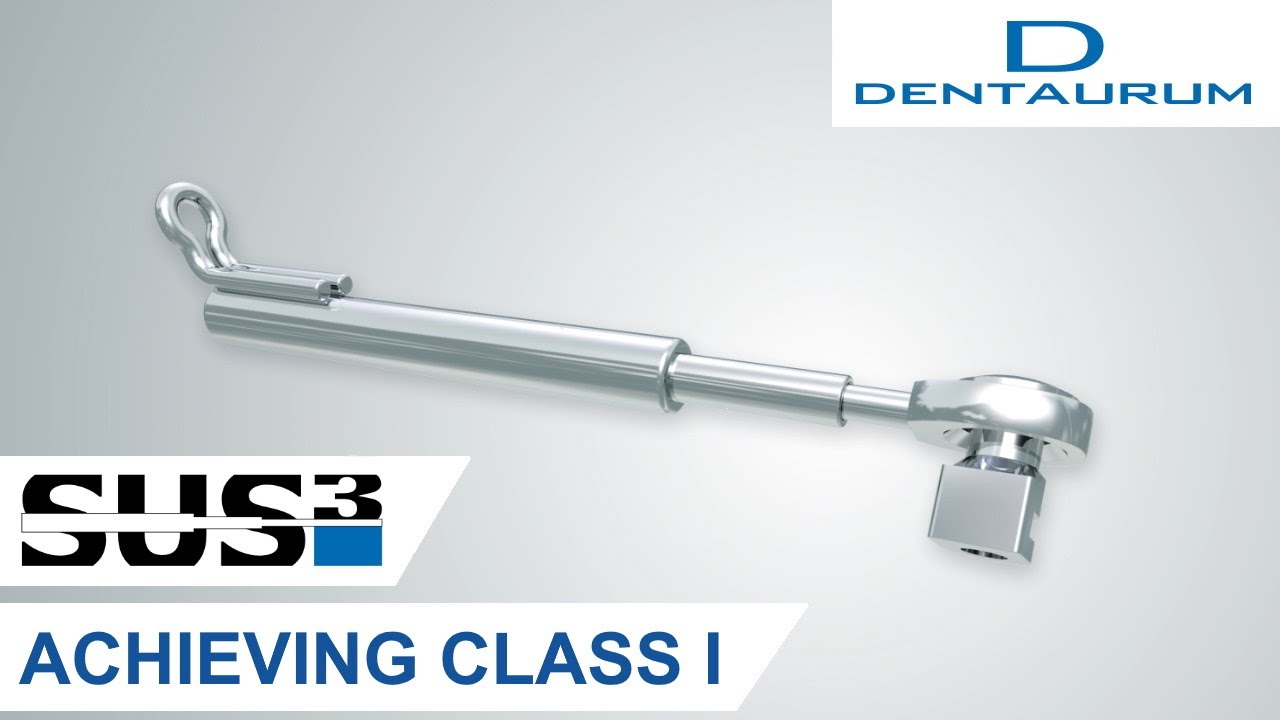 SUS3 - Sabbagh Universal Spring - YouTube