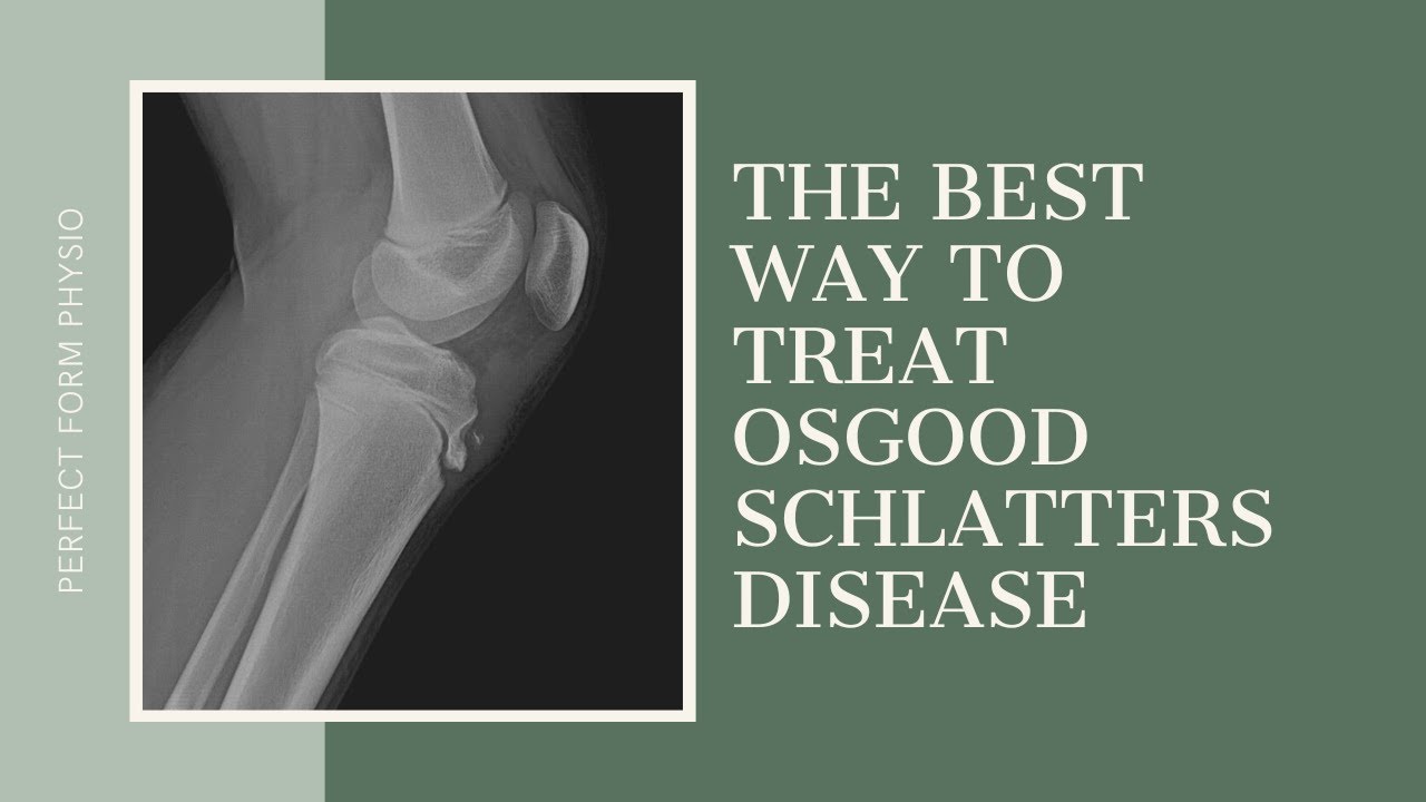 The Best Treatment For Osgood Schlatters Disease With Lisa Howell Youtube