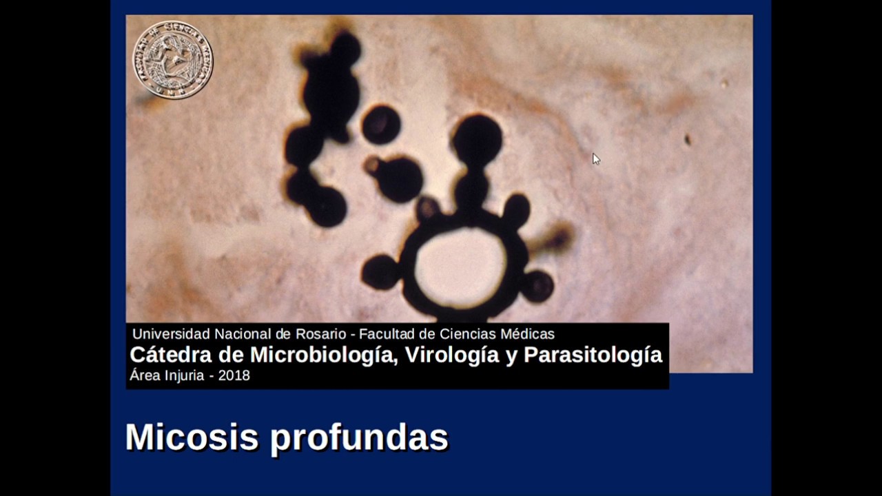 Seminario Injuria 14(A) - Micosis profundas - YouTube