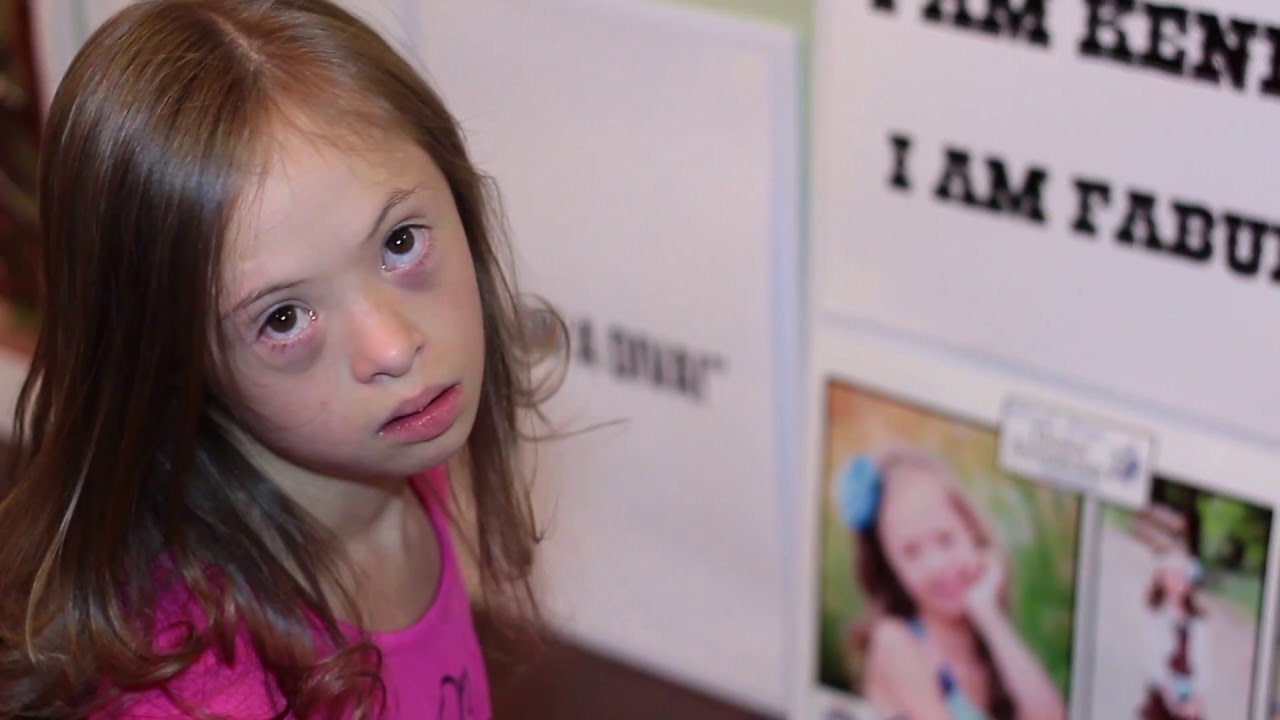 Mother Of Girl With Down Syndrome Overcomes Negativity Youtube