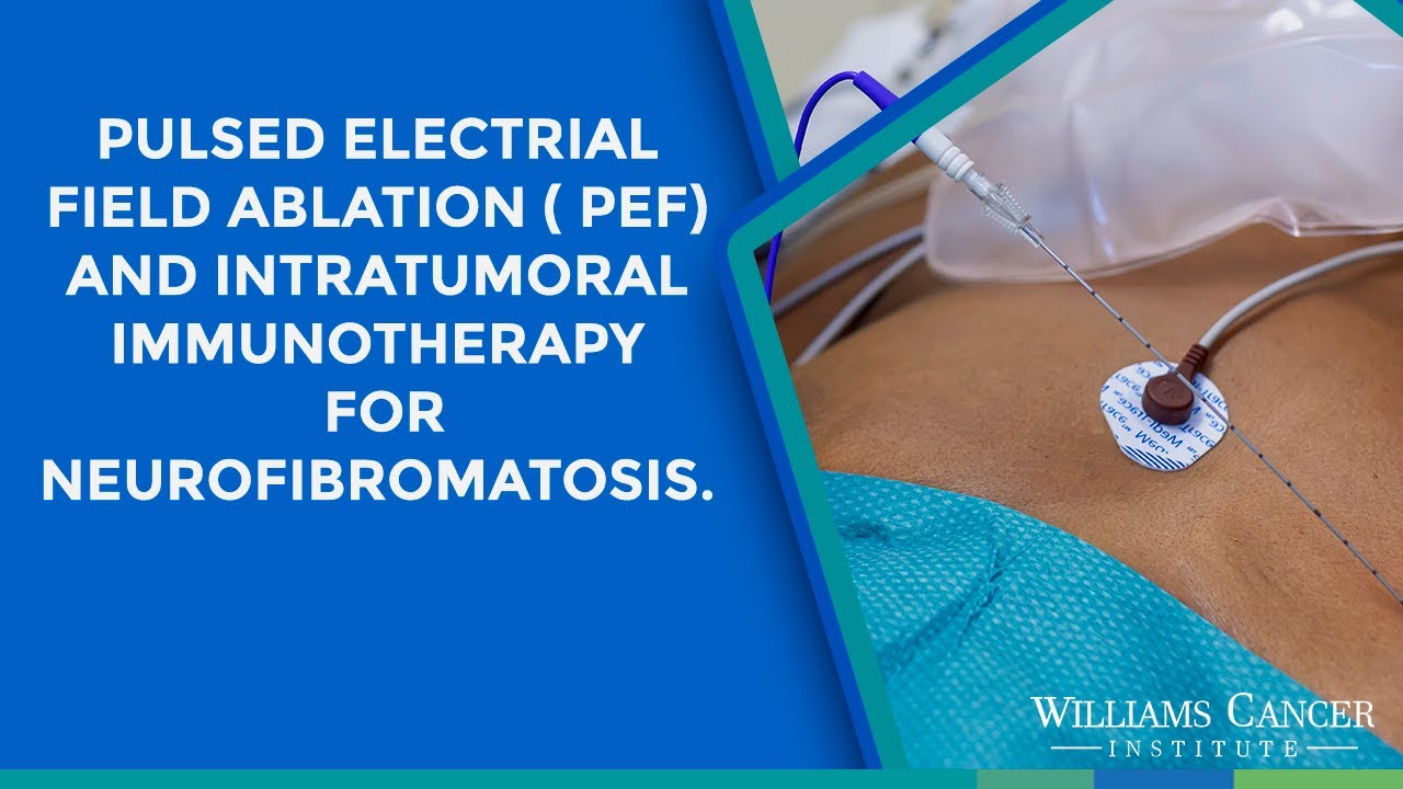Pulsed Electric Field Ablation (PEF) and Intratumoral Immunotherapy for ...