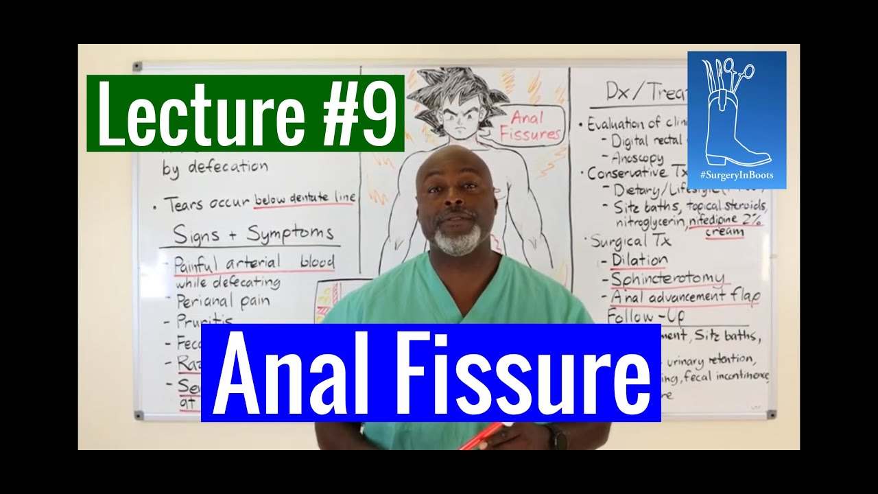 Lecture #9: Anal Fissure - YouTube