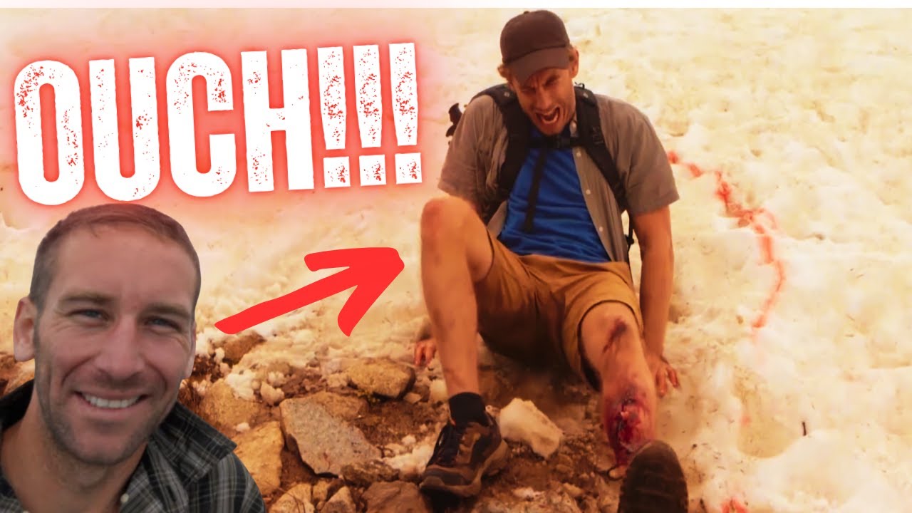 Compound Fracture in the Backcountry | Disastrous Hike in Kings Canyon ...