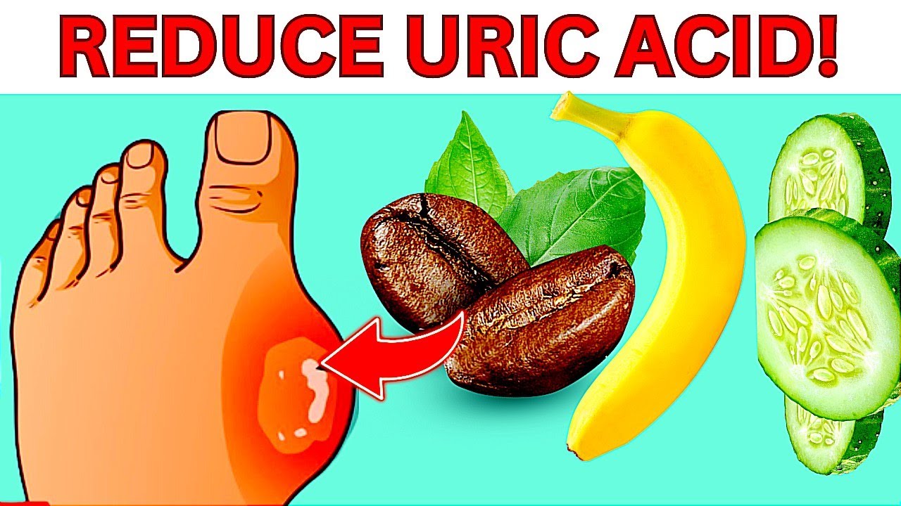 "Beat GOUT: 8 Foods To REDUCE URIC ACID Levels Naturally!" - YouTube